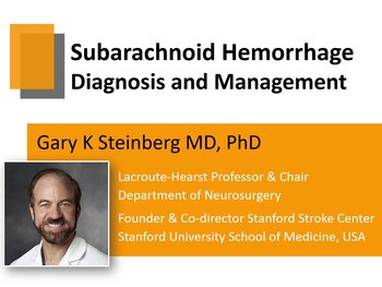 Subarachnoid hemorrhage diagnosis and management | HSTalks