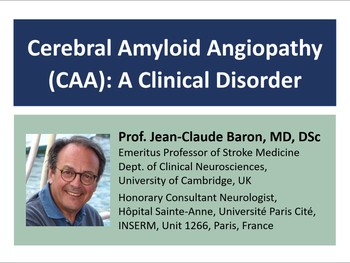 Cerebral amyloid angiopathy (CAA): a clinical disorder | HSTalks